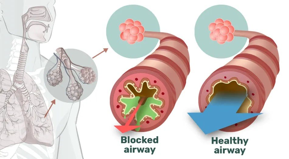 The Viral Lung Cleaning Device That Helps You Breathe Better...
