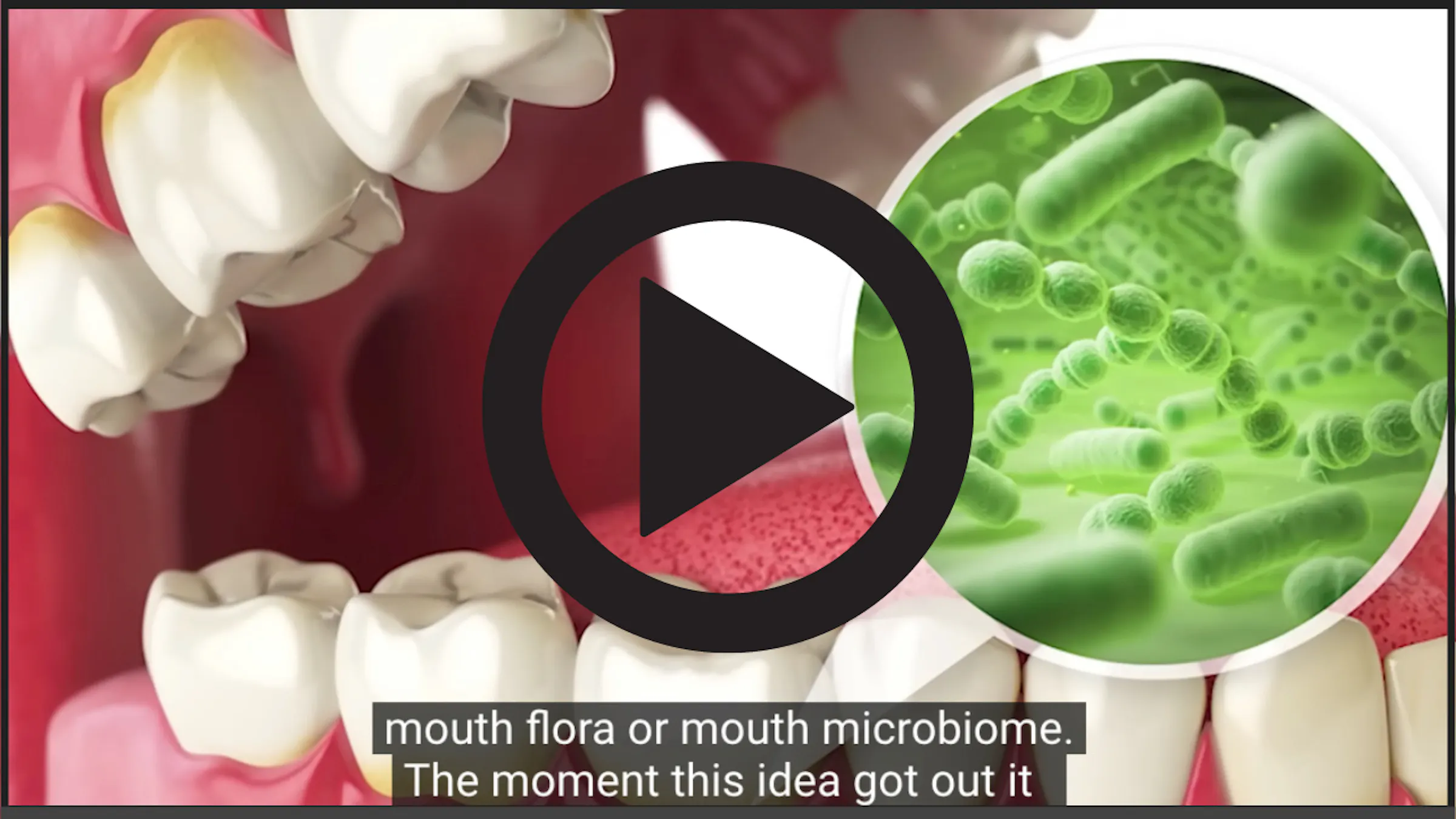 How To Stop Bleeding Gums